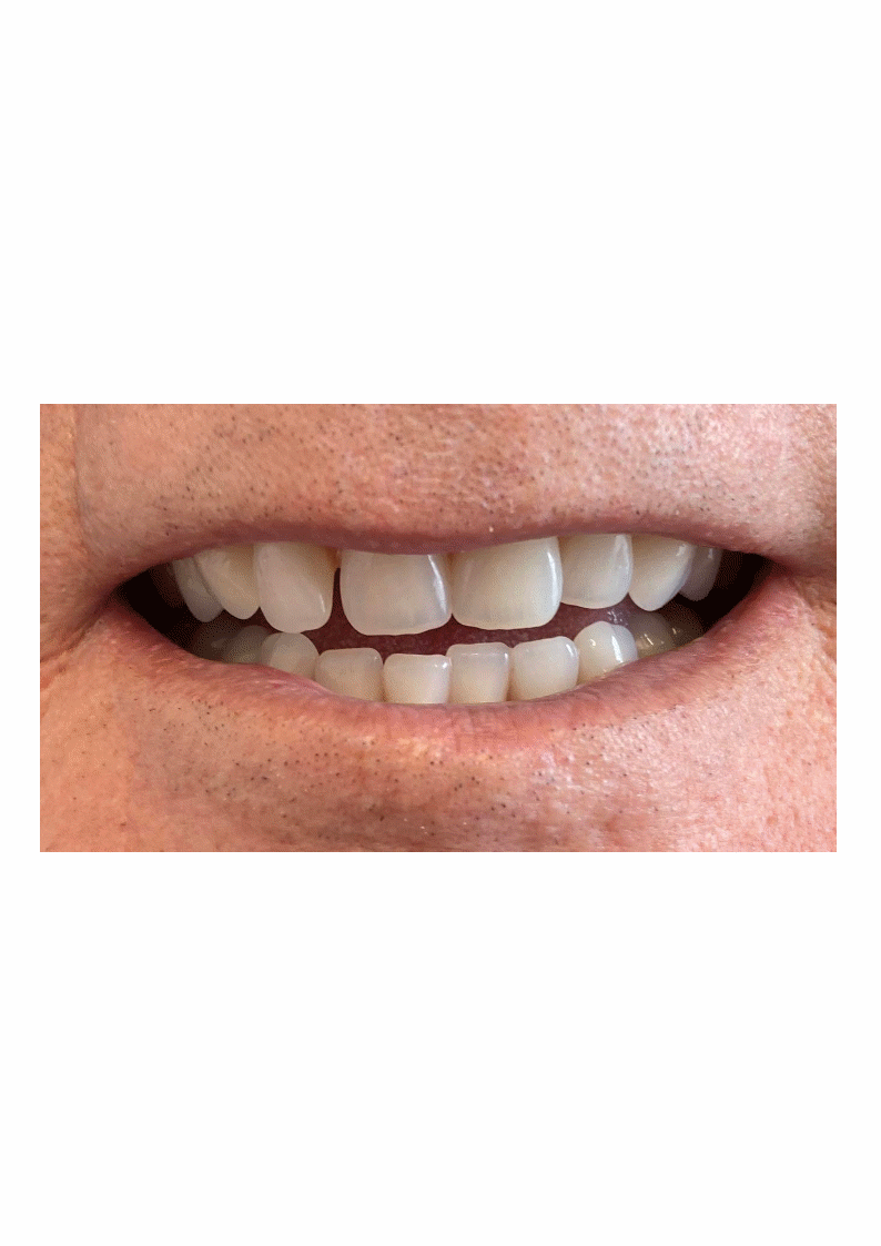 Our Range – Beverley Denture Clinic